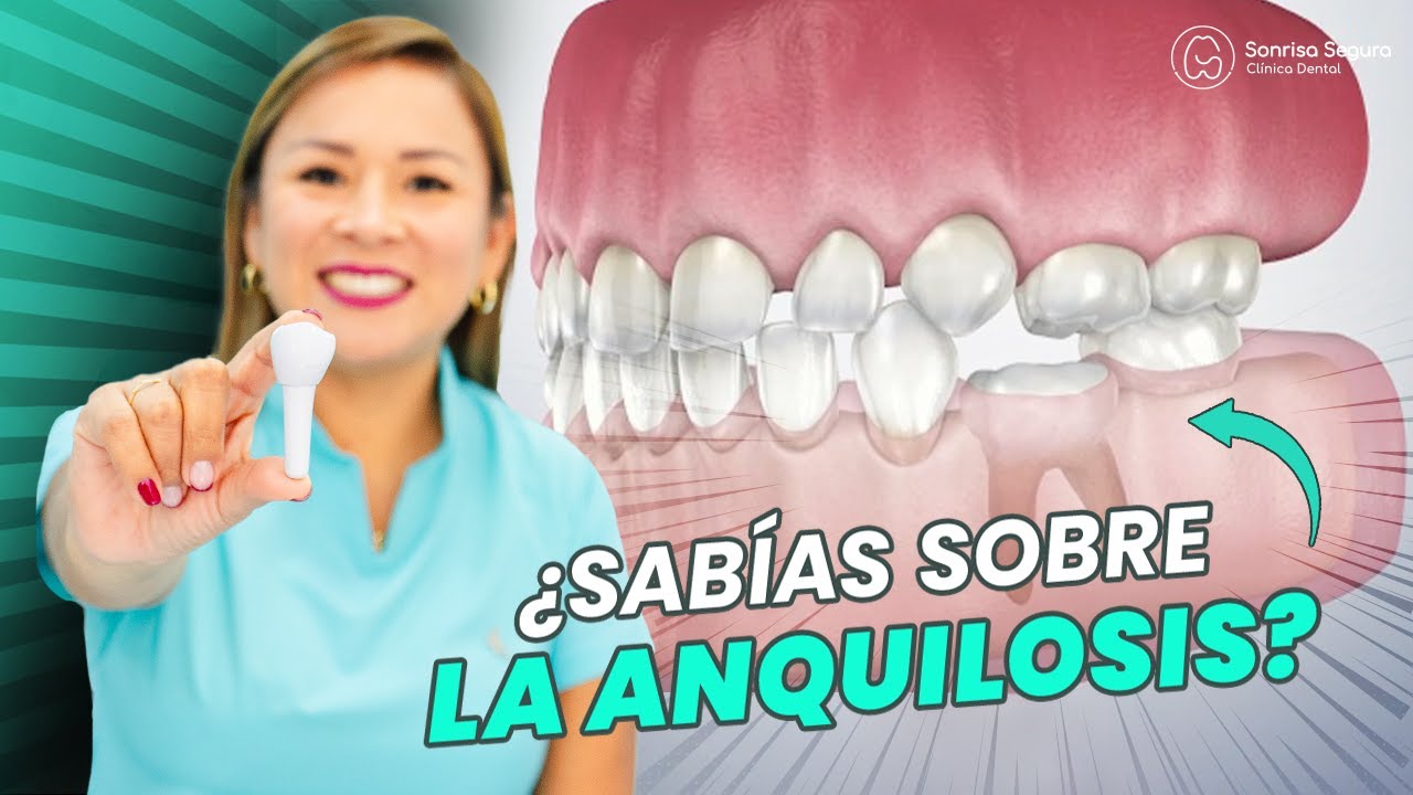 Causas, Síntomas y Tratamientos para una Sonrisa Perfecta - ORTODONCIA ...