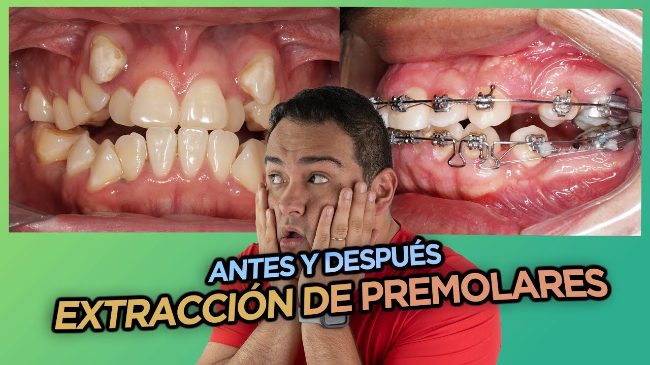 Soluciones y Tratamientos Efectivos - ORTODONCIA MODERNA - Todo sobre ...