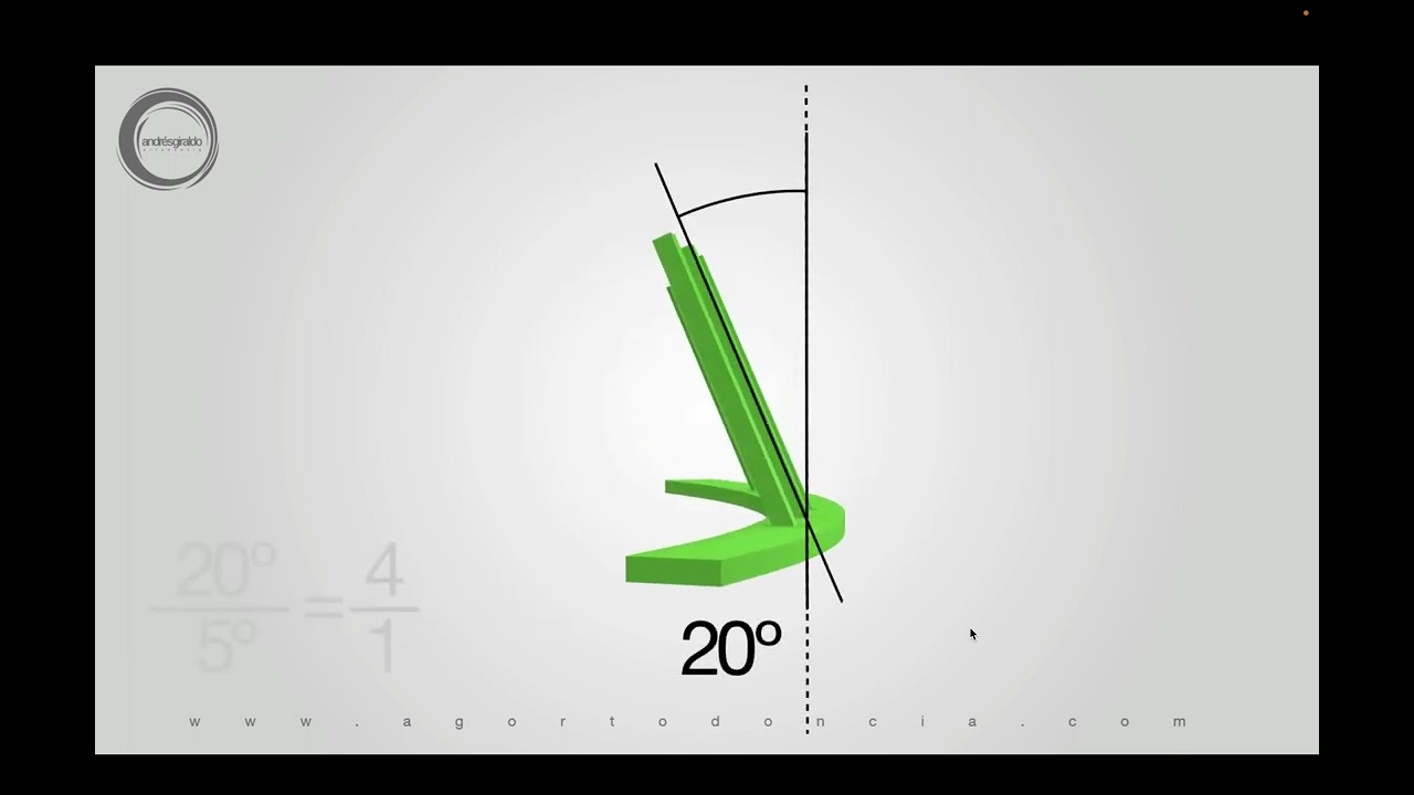 ¿Qué es el TIP en Ortodoncia? Definición y Aplicaciones en el ...