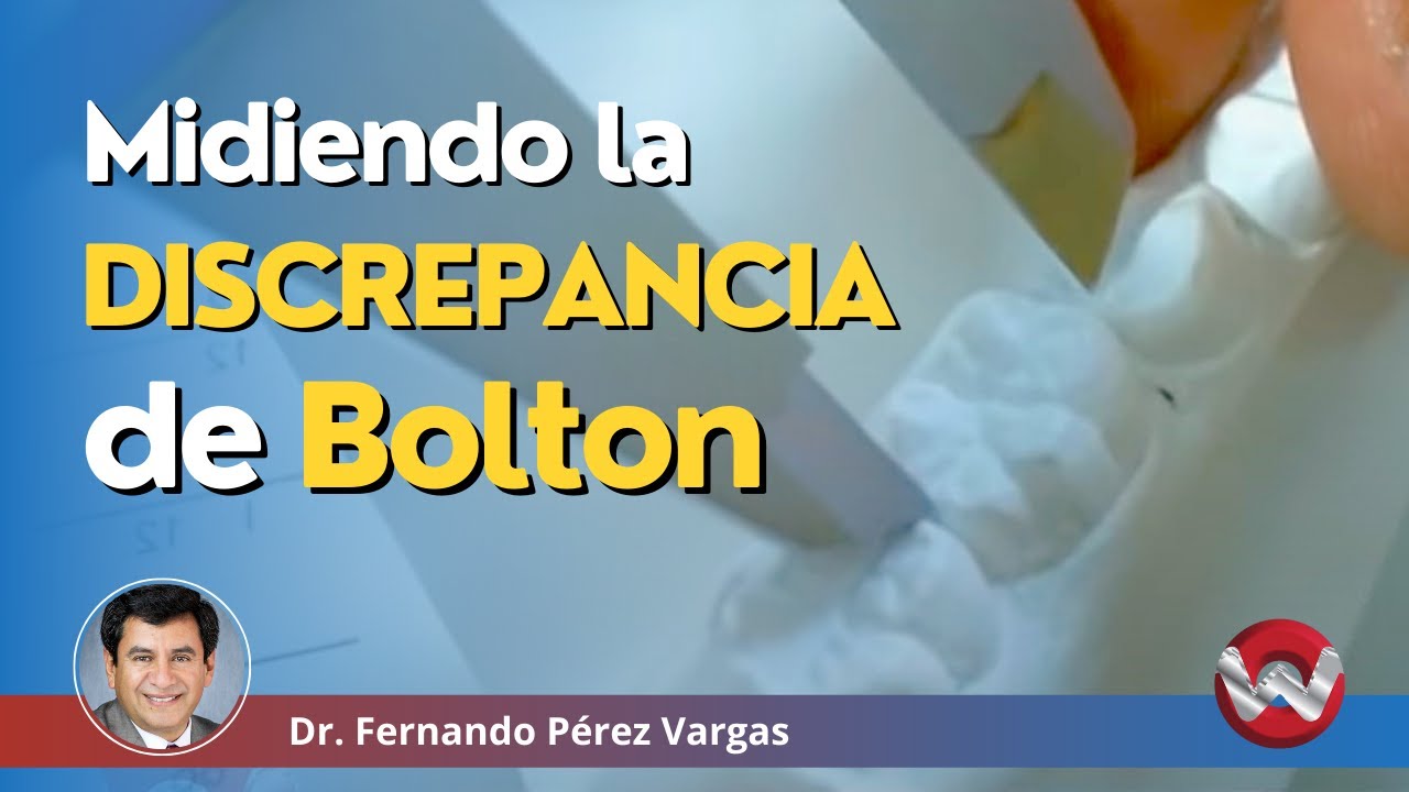 ¿Qué es la discrepancia total en ortodoncia? Causas, síntomas y ...