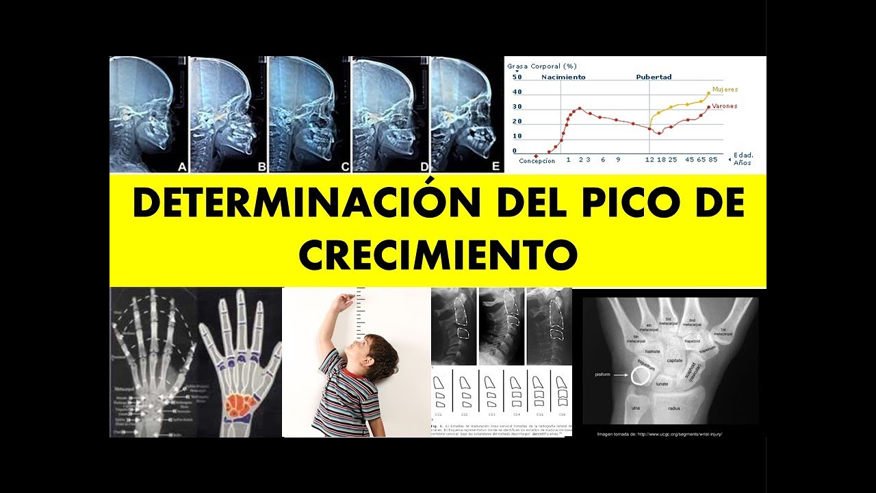 Cómo los Estadios de Crecimiento Afectan el Desarrollo Dental ...