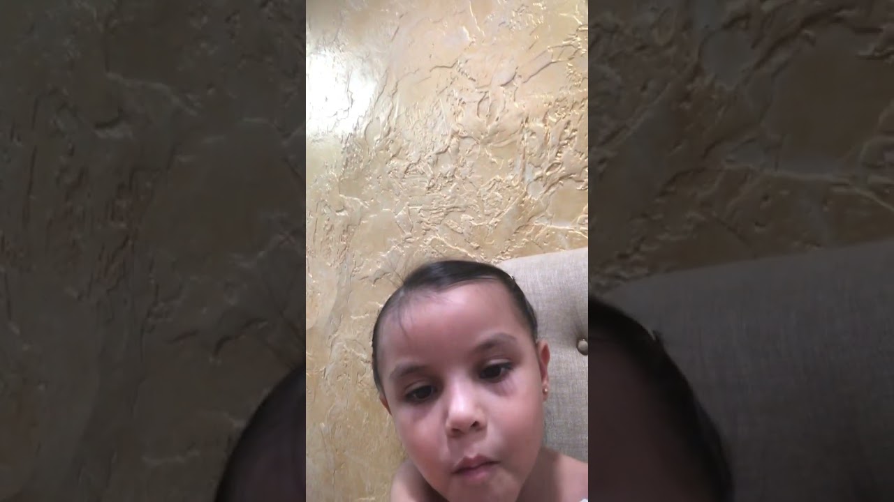 ¿Qué es el IDAP en ortodoncia? Conceptos básicos y beneficios para un ...