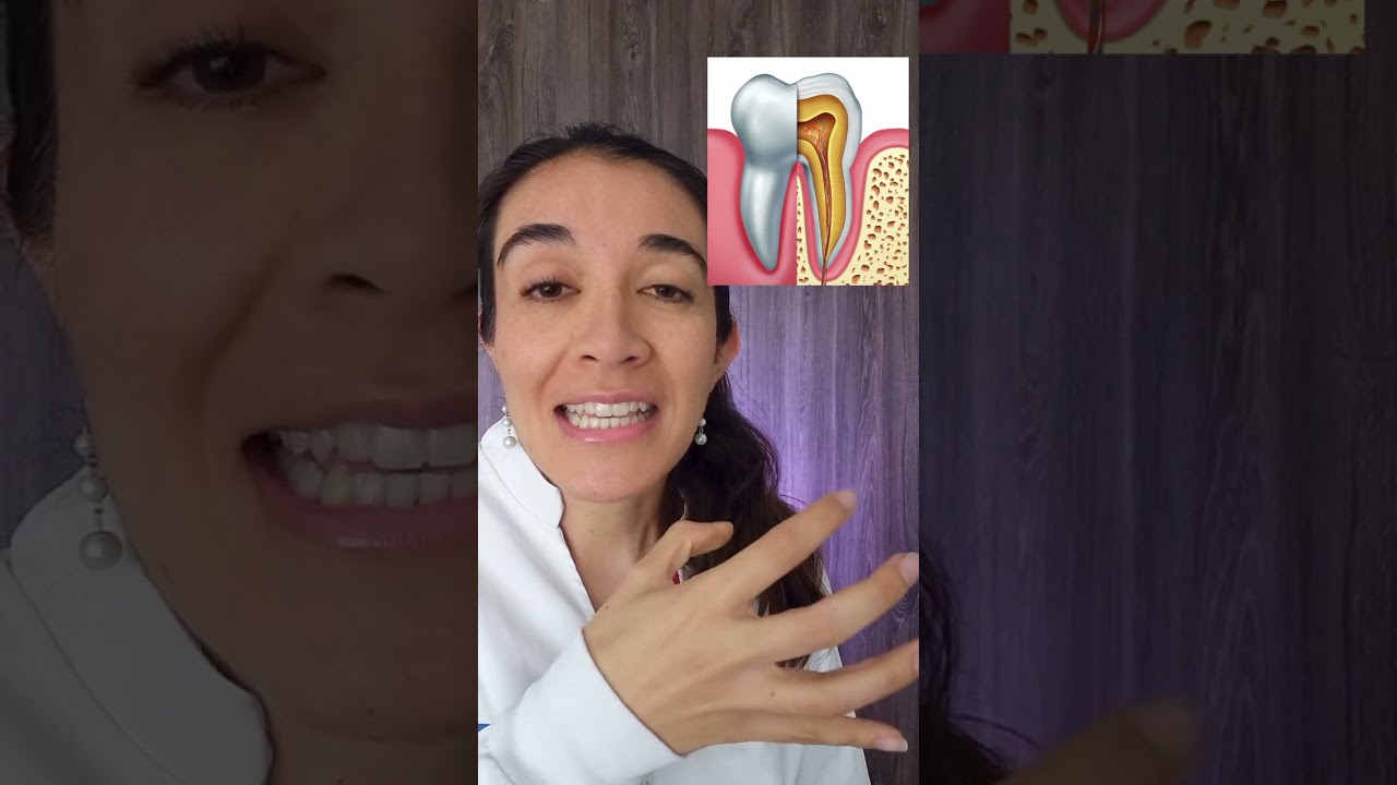 ¿Qué es el ligamento periodontal ensanchado y cómo afecta a la ...