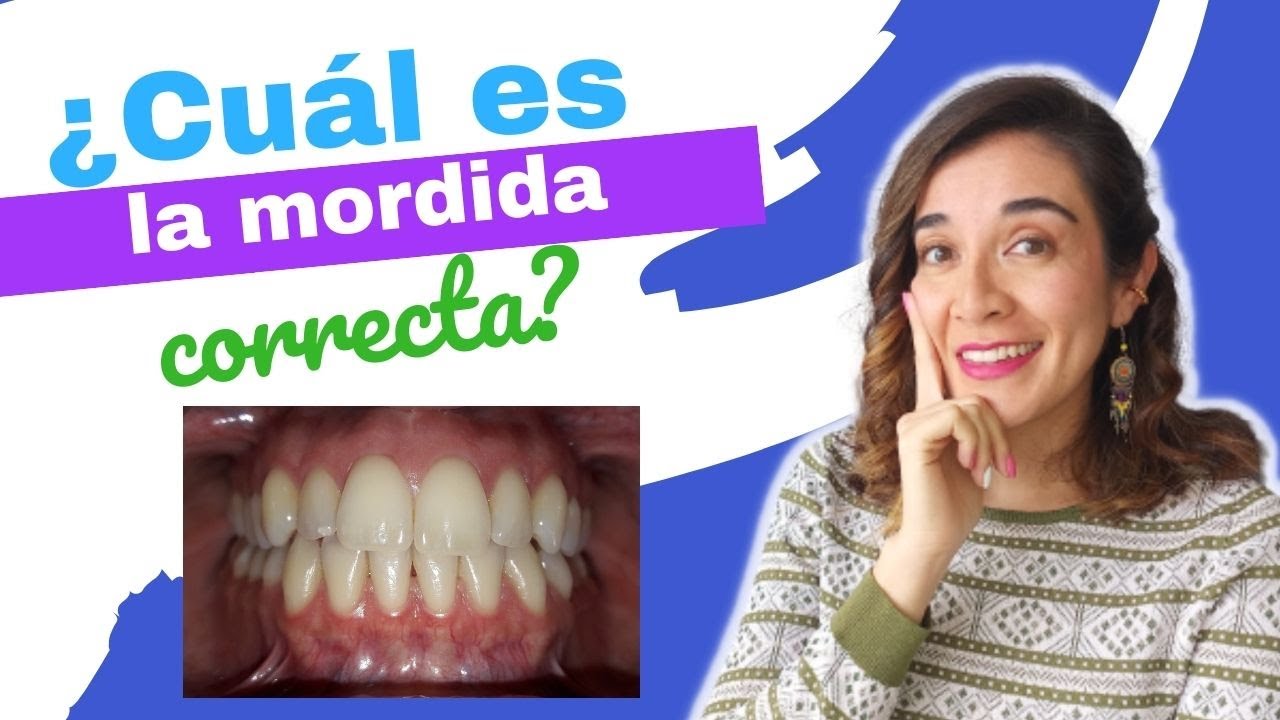 ¿Cuál es la mordida correcta en ortodoncia? Guía para un perfecto ...