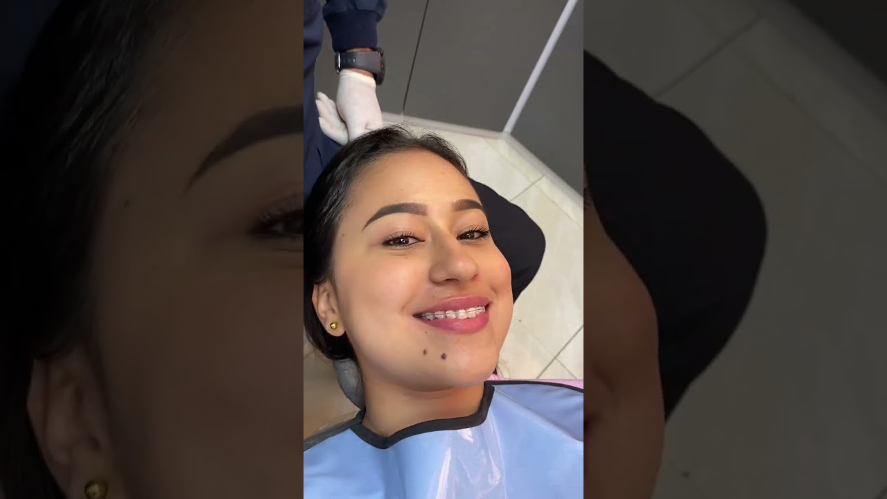 Descubre la Elegancia y Eficiencia en el Tratamiento de Ortodoncia - ORTODONCIA MODERNA - Todo ...