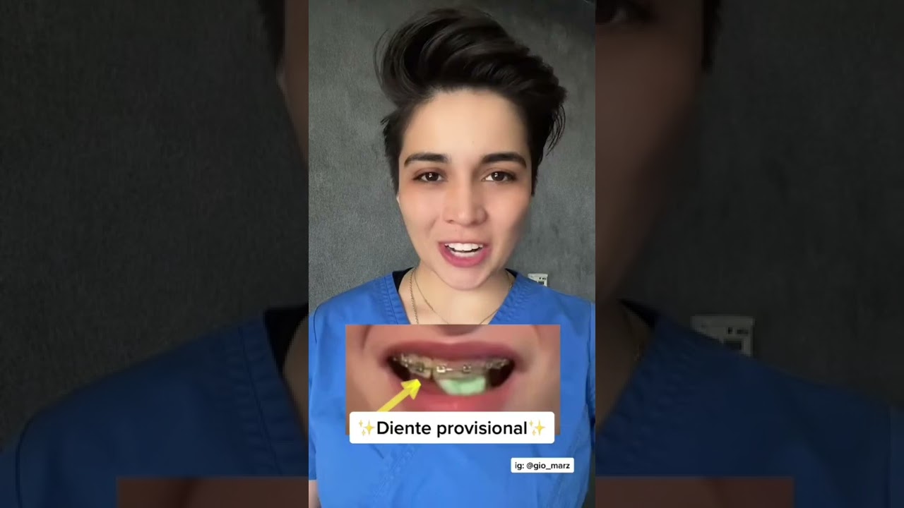 ¿Se puede comer chicle con ortodoncia? Conoce los riesgos y ...