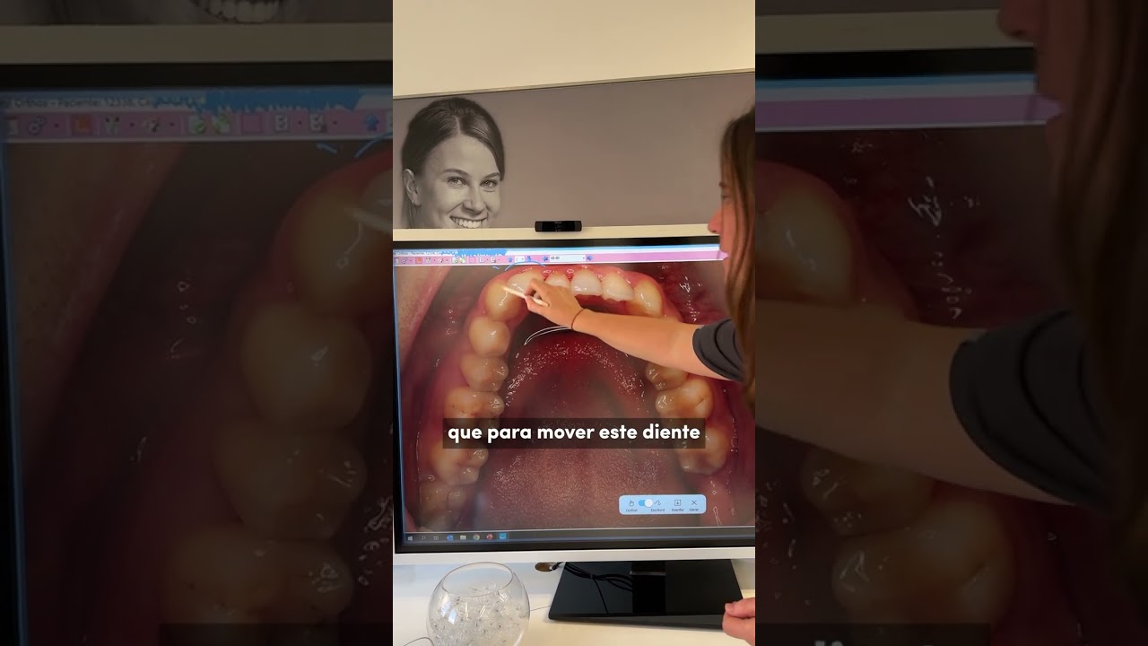 Descubre las Ofertas de TIIZ - ORTODONCIA MODERNA - Todo sobre salud bucal